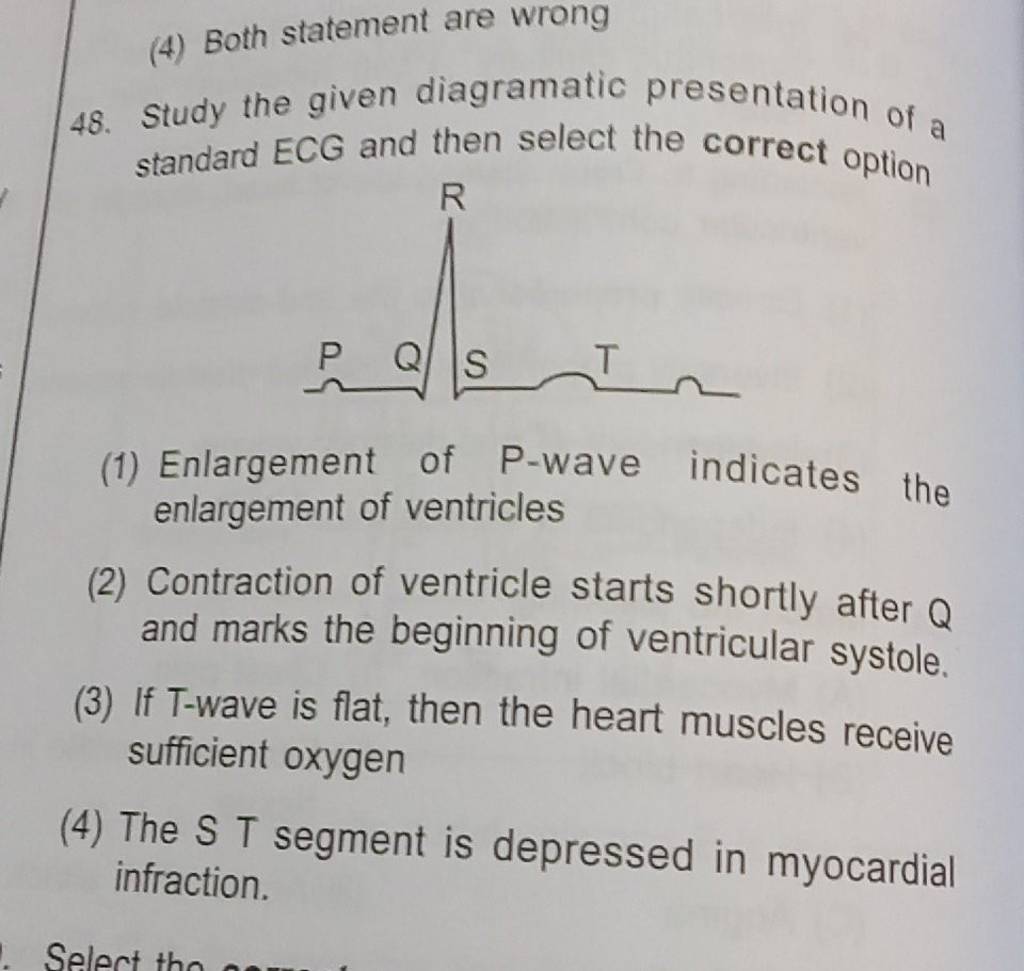 Study the given diagramatic presentation of a standard ECG and then selec..