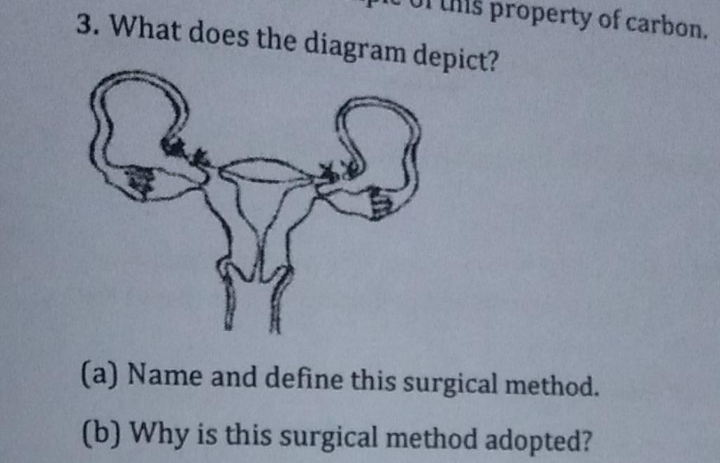 3. What does the diagram depict? (a) Name and define this surgical method..