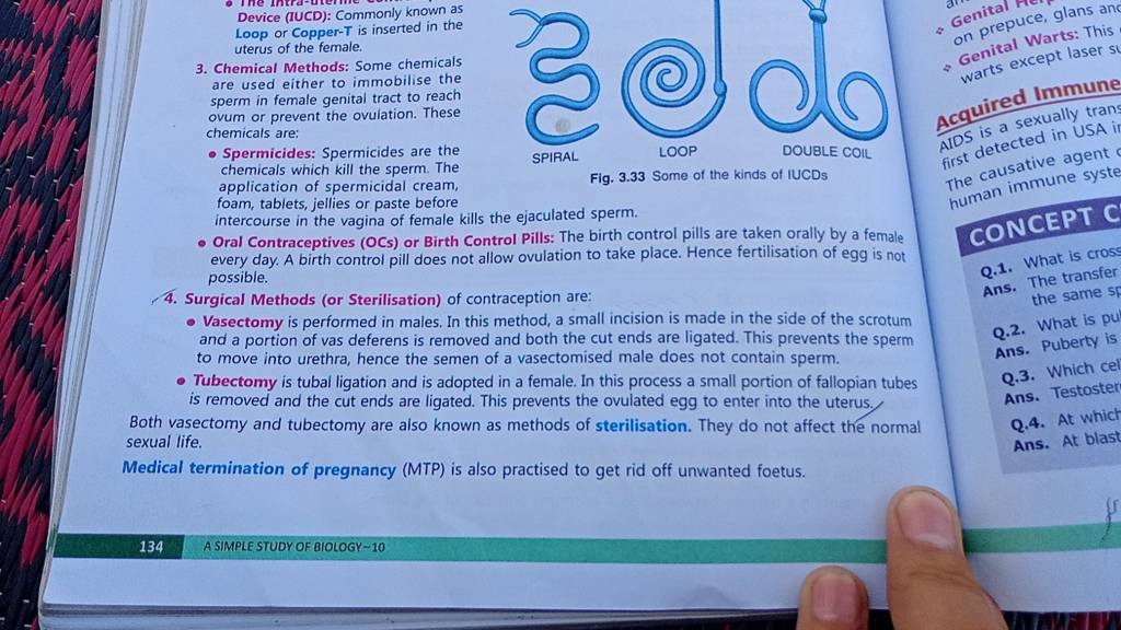 Device (IUCD): Commonly known as Loop or Copper-T is inserted in the uter..