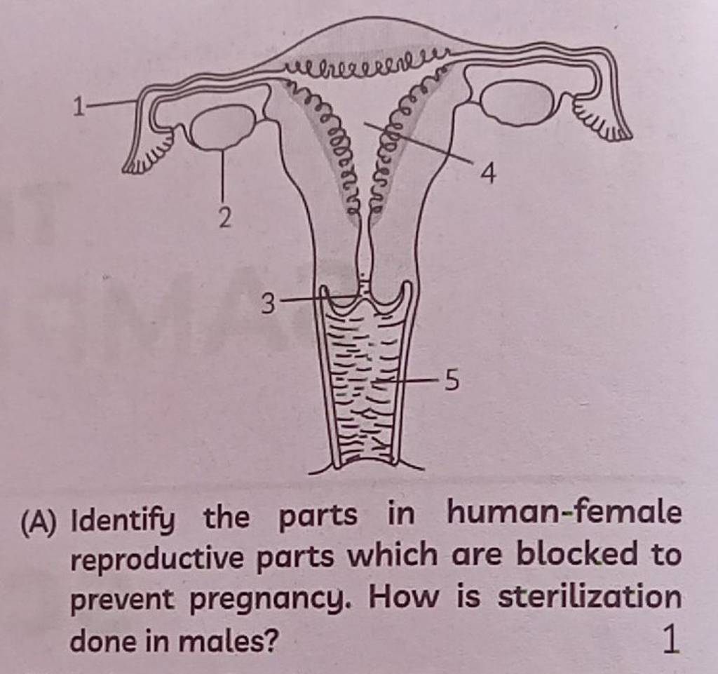 (A) Identify the parts in human-female reproductive parts which are block..