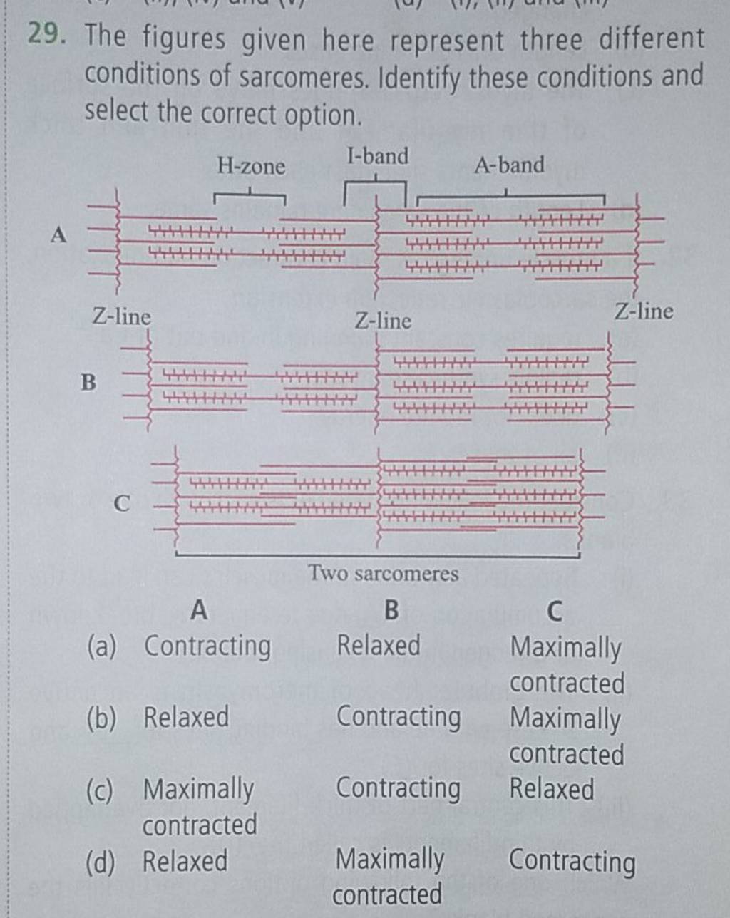 29. The figures given here represent three different conditions of sarcom..