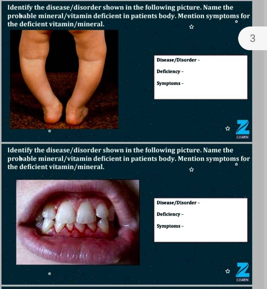 Identify the disease/disorder shown in the following picture. Name the pr..
