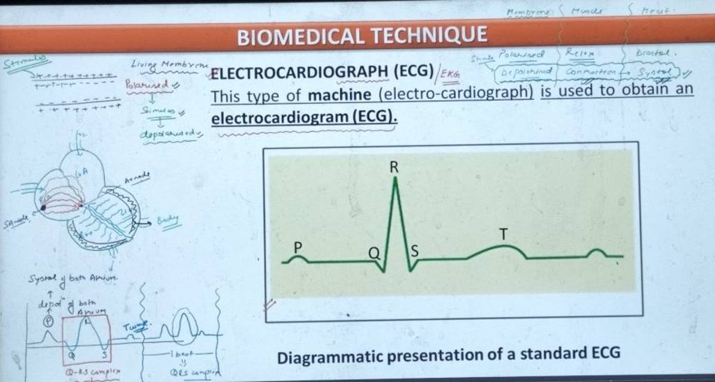 BIOMEDICAL TECHNIQUE ELECTROCARDIOGRAPH (ECG) EKG This type of machine (e..