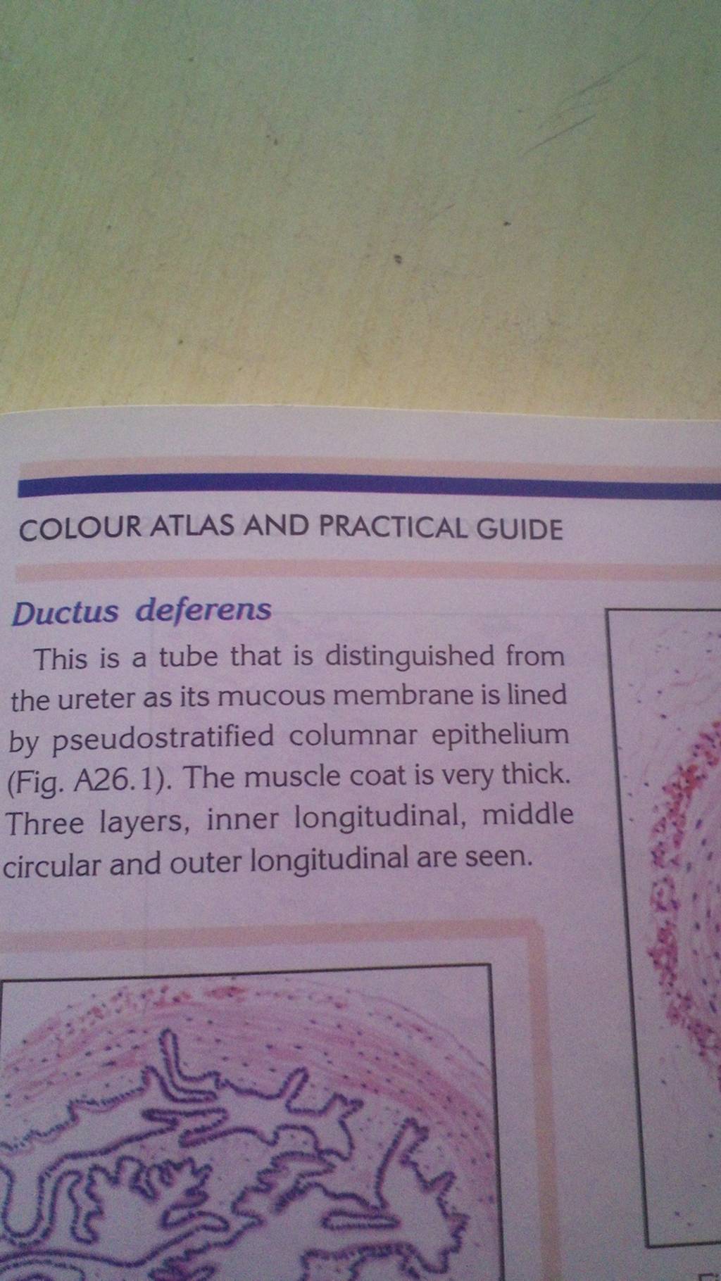COLOUR ATLAS AND PRACTICAL GUIDE Ductus deferens This is a tube that is d..