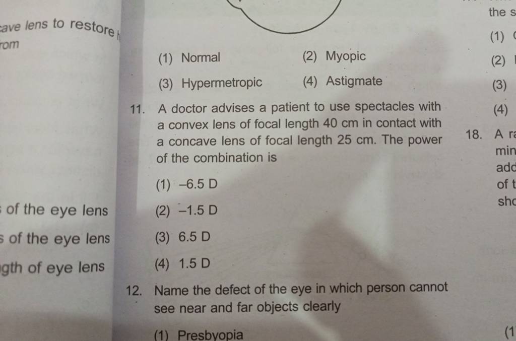 Name the defect of the eye in which person cannot see near and far object..