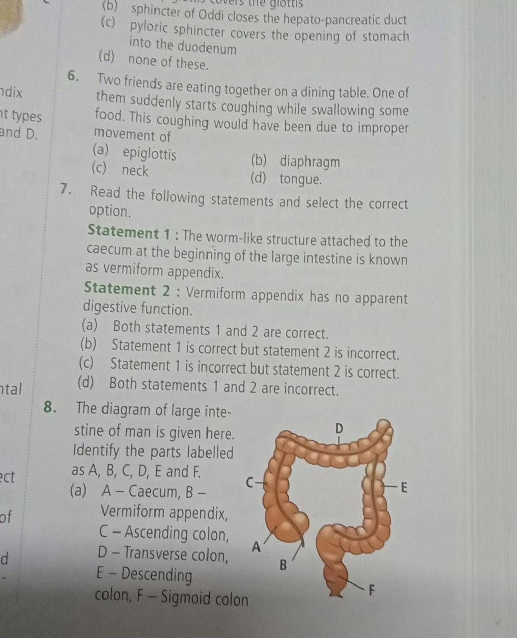 The diagram of large intestine of man is given here. Identify the parts l..