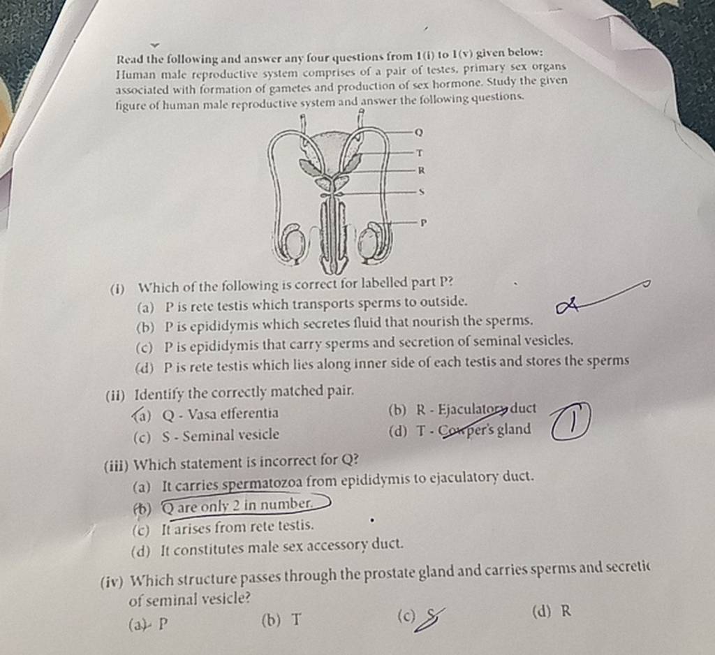 Which Structure Passes Through The Prostate Gland And Carries Sperms And
