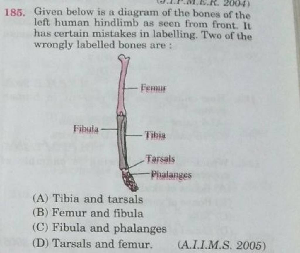 Given below is a diagram of the bones of the left human hindlimb as seen