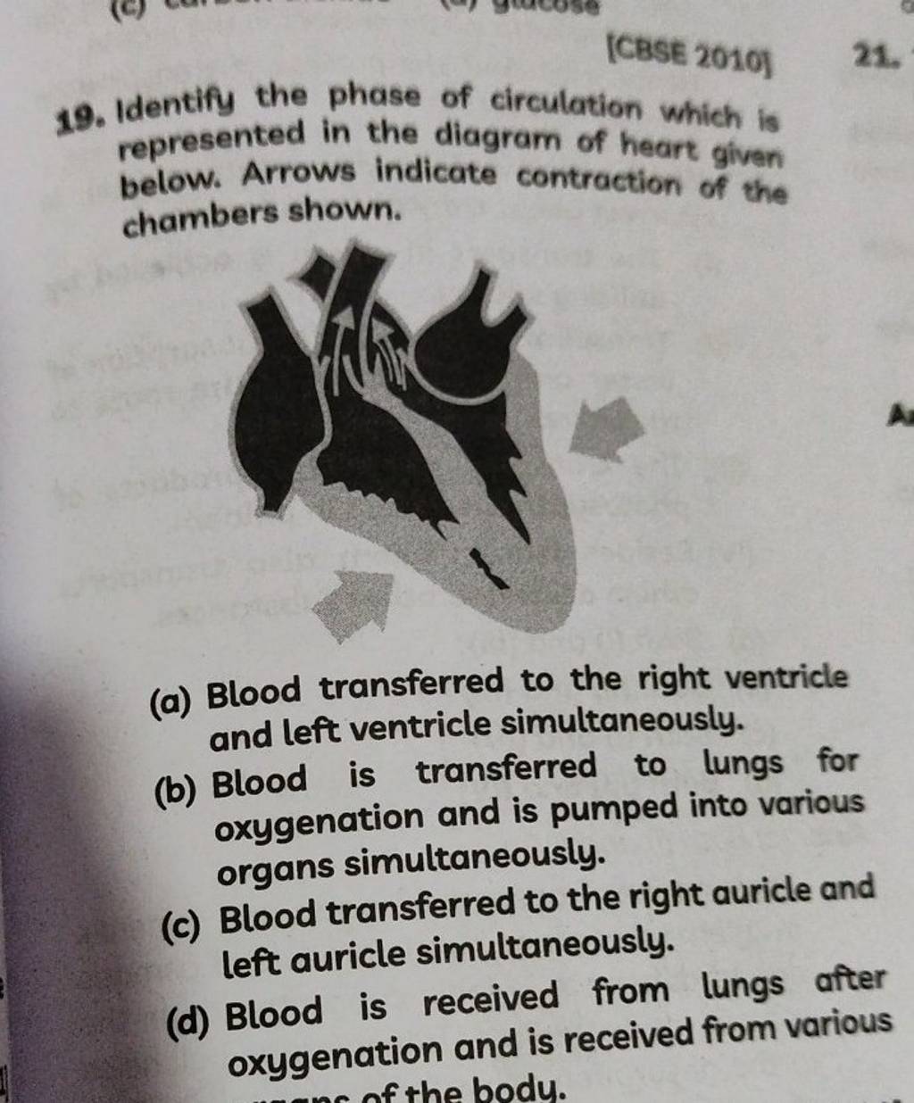 Identify the phase of circulation which is represented in the diagram of