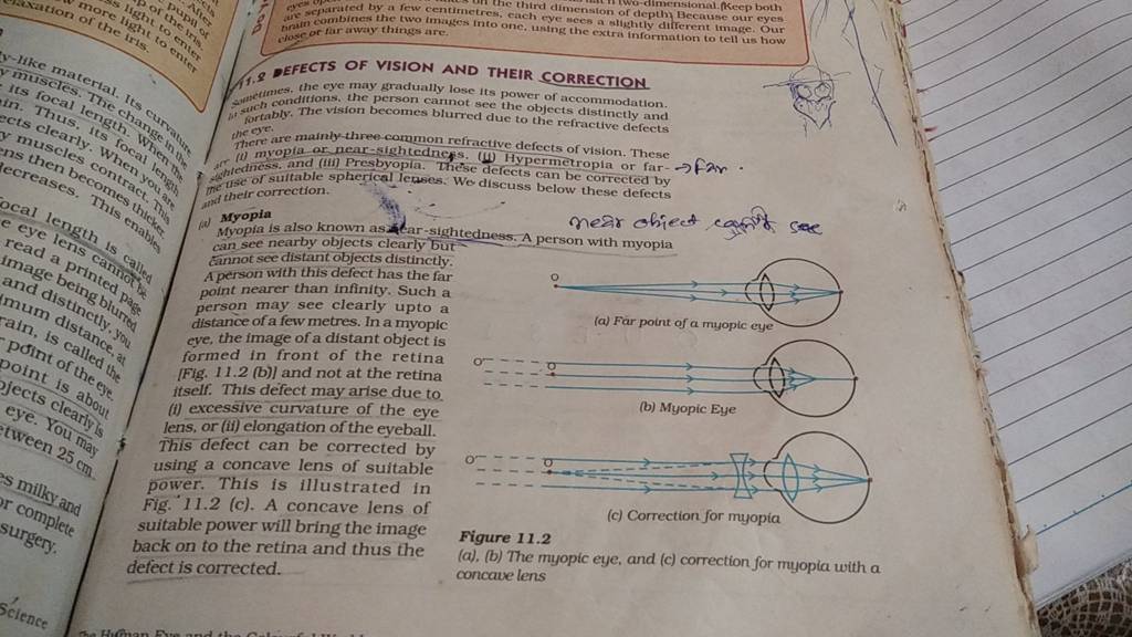 f1. Q DEFECTS OF VISION AND THEIR CORRECTION the eye: there are mainly th..