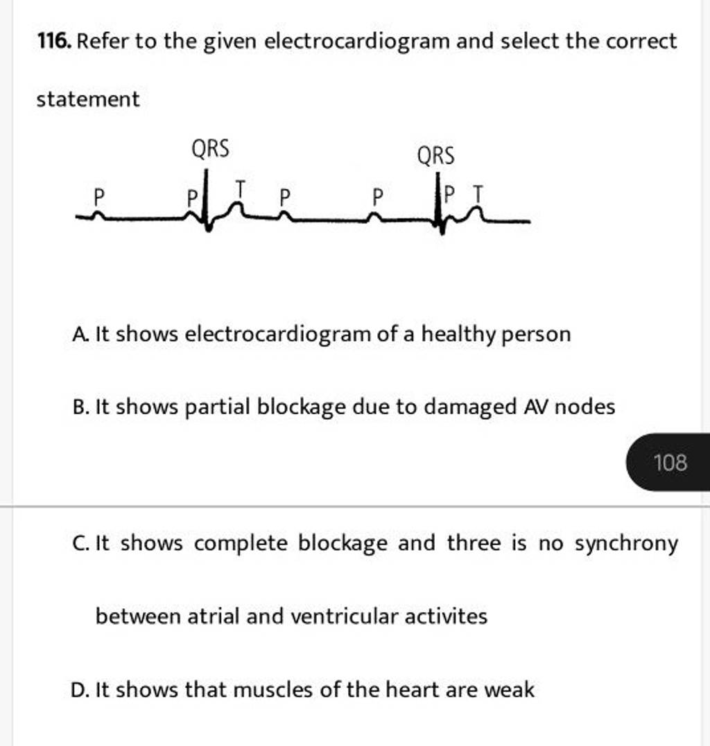 116. Refer to the given electrocardiogram and select the correct statemen..