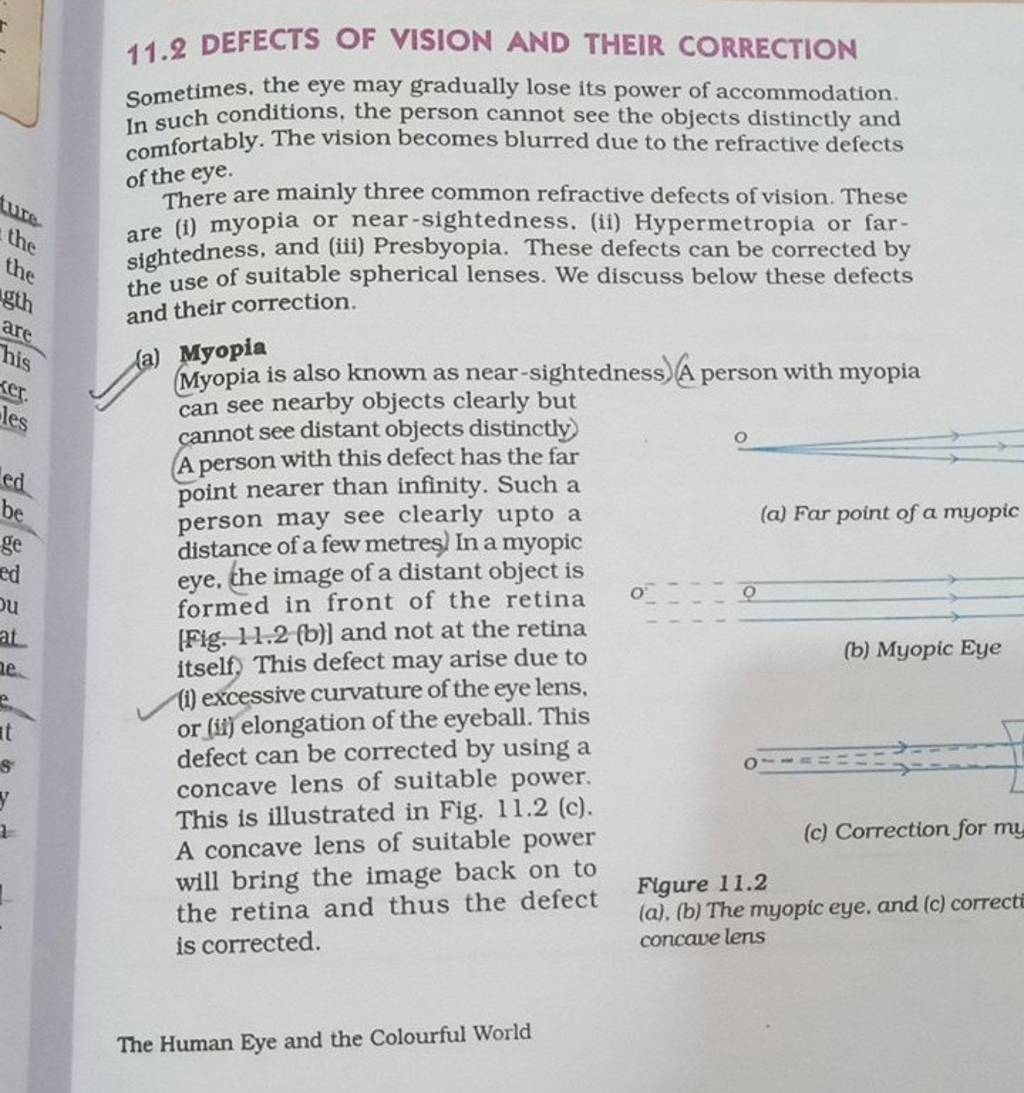 11.2 DEFECTS OF VISION AND THEIR CORRECTION Sometimes. the eye may gradua..