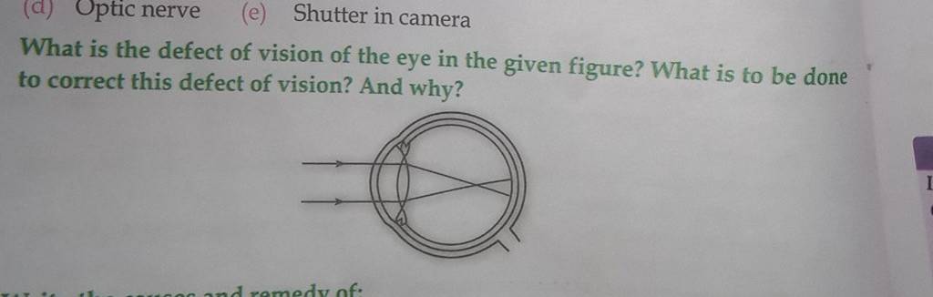 What is the defect of vision of the eye in the given figure? What is to b..