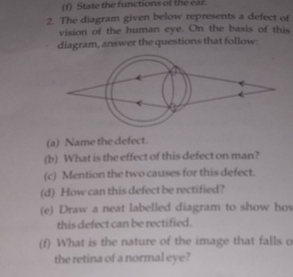 The diagram given below represents a defect of vision of the human eye. O..