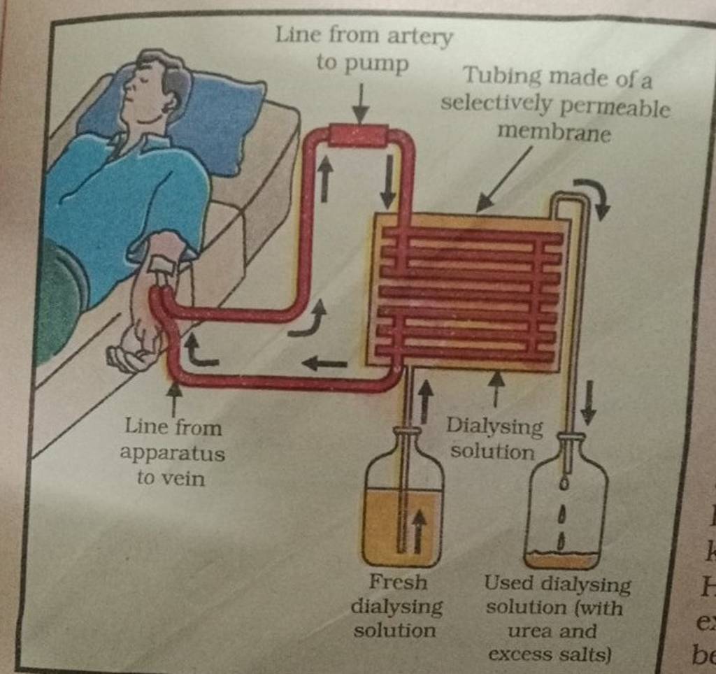 Line from apparatus to vein Line from artery to pump Tubing made of a sel..