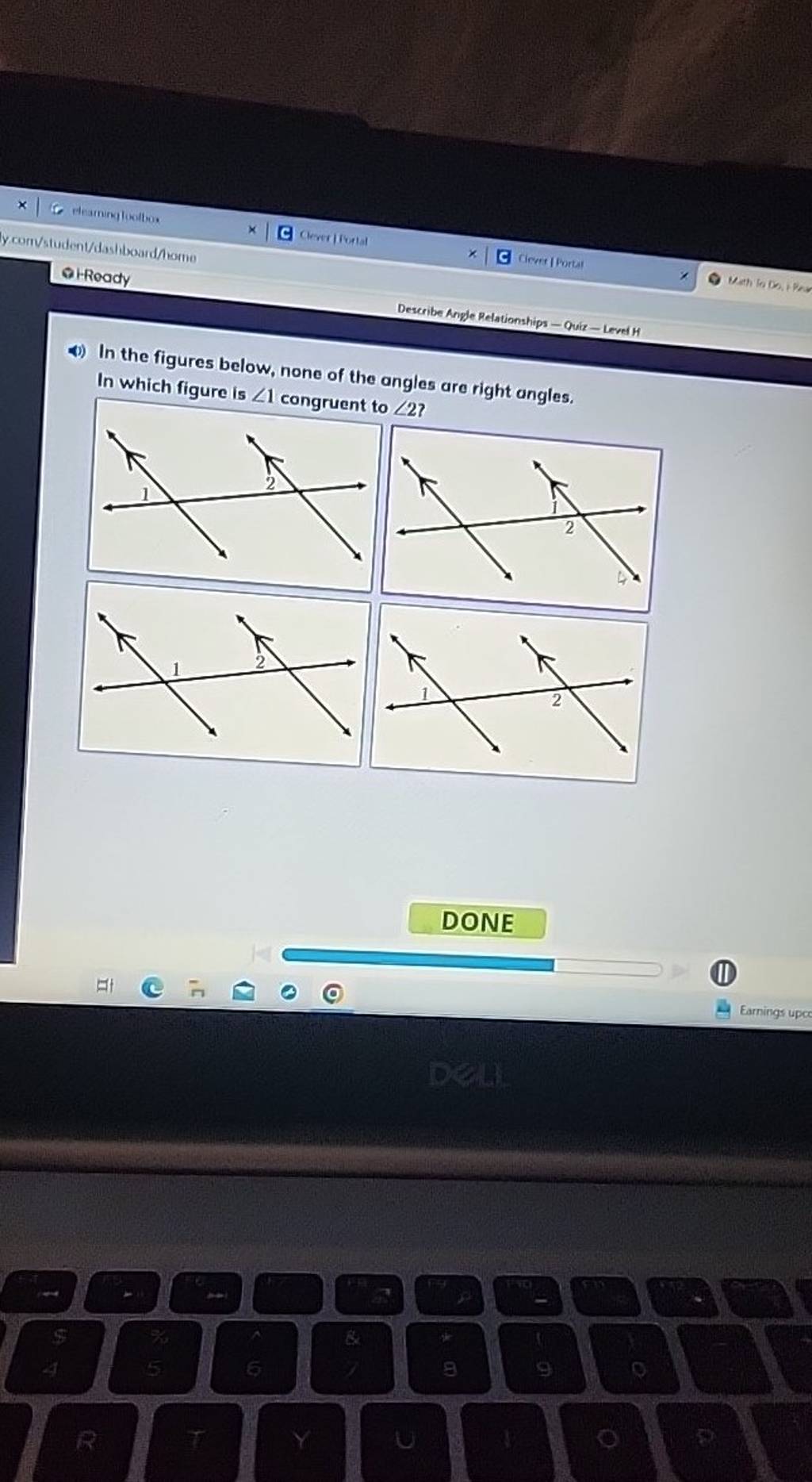 4) In the figures below, none of the angles are right angles. In which fi..