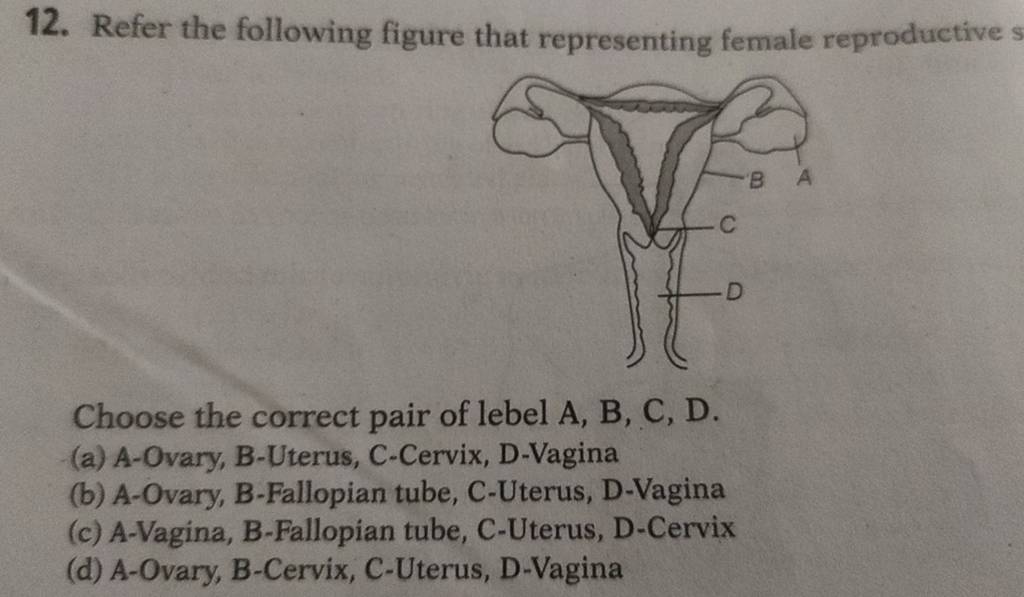 Refer the following figure that representing female reproductive Choose t..