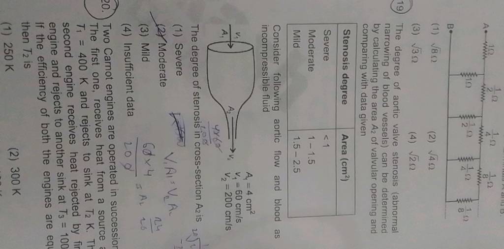 The degree of aortic valve stenosis (abnormal narrowing of blood vessels..
