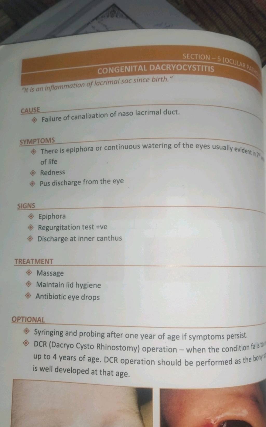 CONGENITAL DACRYOCYSTITIS "It is an inflammation of lacrimal sac since bi..